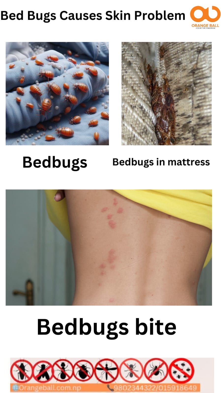 Bed Bugs Bite, Identification and Prevention